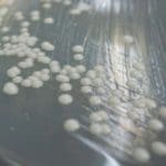 Candida albicans | Microchem Laboratory