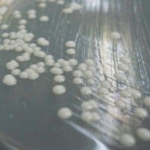 Candida albicans | Microchem Laboratory