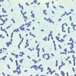 Enterococcus faecium | Microchem Laboratory
