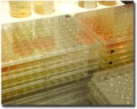 Minimum Bactericidal Concentration (MBC) Test | Microchem Laboratory