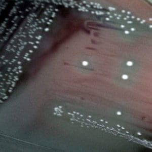 Streptococcus pyogenes | Microchem Laboratory