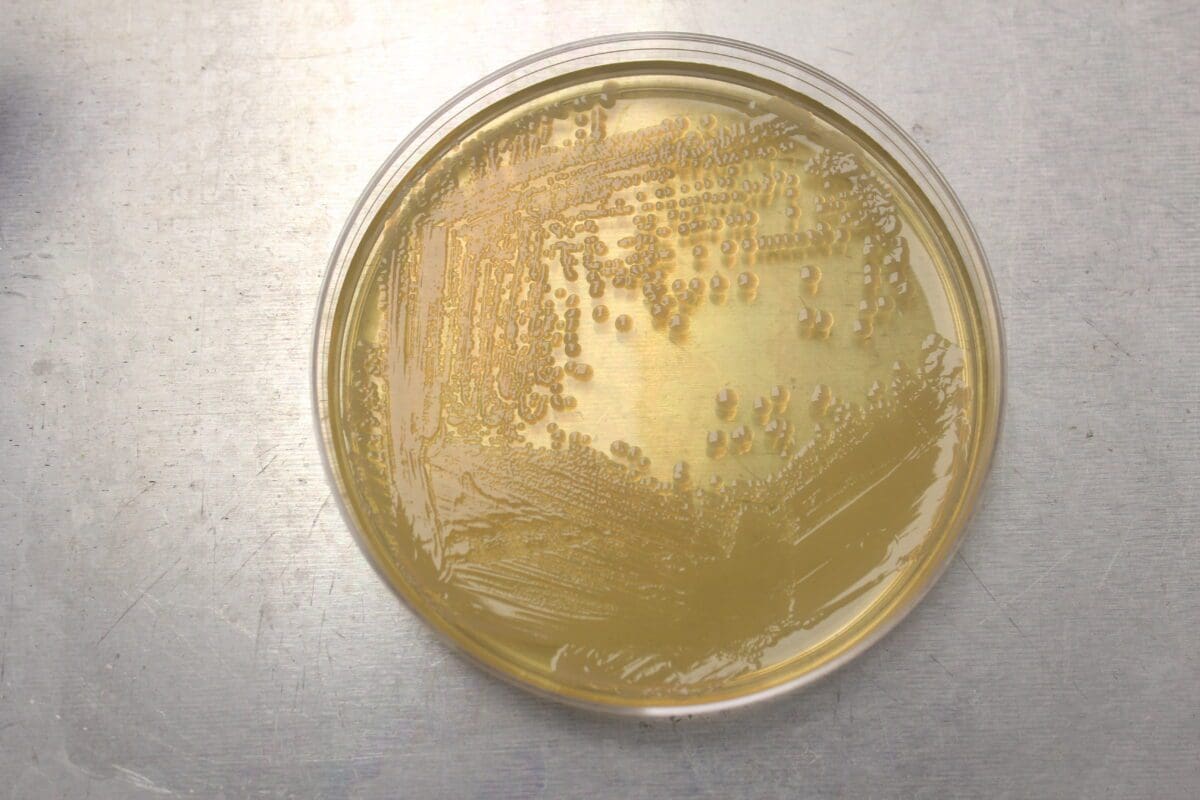 Salmonella enterica | Microchem Laboratory