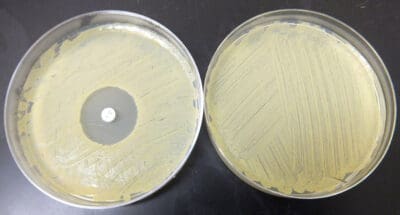 Zone of Inhibition Test - Kirby-Bauer Test | Microchem Laboratory