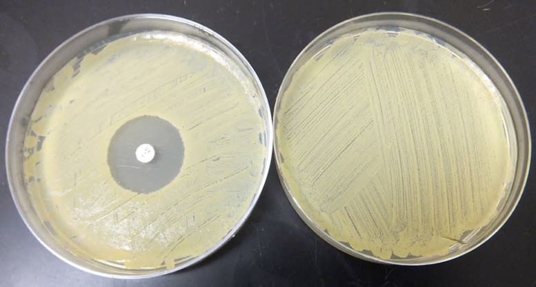 Zone of Inhibition Test - Kirby-Bauer Test | Microchem Laboratory