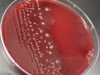 Clostridium septicum | Microchem Laboratory