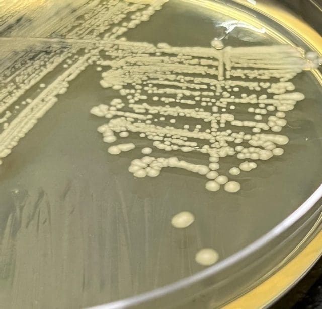 Klebsiella aerogenes - Microchem Laboratory