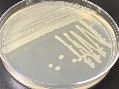 Pseudomonas putida | Microchem Laboratory