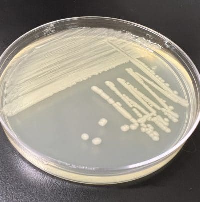 Gram-Negative Page 1 of 1 | Microchem Laboratory