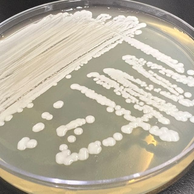 Staphylococcus haemolyticus - Microchem Laboratory