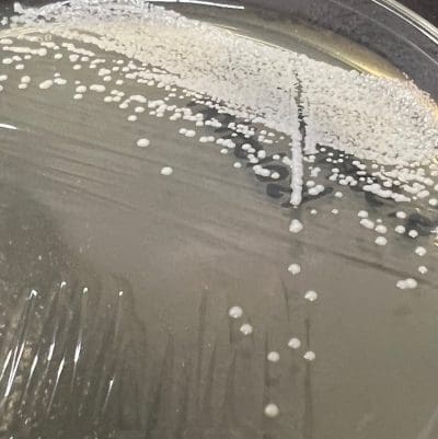 Bacteria Page 1 of 1 | Microchem Laboratory