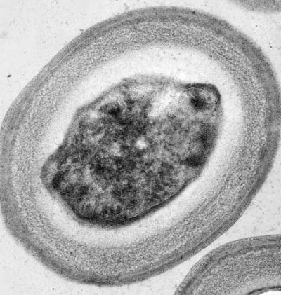 Geobacillus stearothermophilus | Microchem Laboratory