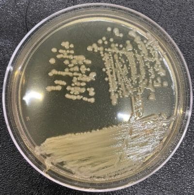 Klebsiella oxytoca | Microchem Laboratory