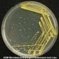 Micrococcus yunnanensis | Microchem Laboratory