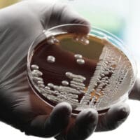 USP Probiotic Testing | Microchem Laboratory